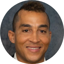 Dr. Menyoli Malafa, MD, Los Angeles, CA | Hand Surgeon